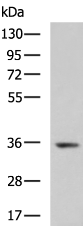 兔抗CLEC1A多克隆抗体,Anti-CLEC1A rabbit polyclonal antibody 生命科学产品与技术服务-生工生物工程 ...