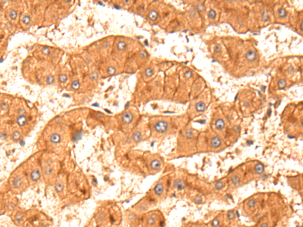 兔抗CLEC10A多克隆抗体,Anti-CLEC10A rabbit polyclonal antibody 生命科学产品与技术服务-生工生物 ...