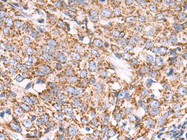兔抗HSPD1多克隆抗体,Anti-HSPD1 rabbit polyclonal antibody 生命科学产品与技术服务-生工生物工程 ...