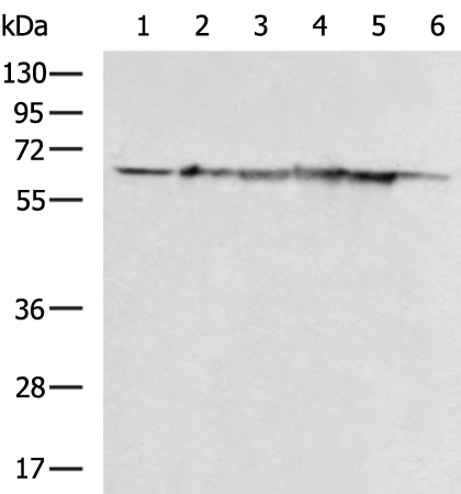 兔抗HSPD1多克隆抗体,Anti-HSPD1 rabbit polyclonal antibody 生命科学产品与技术服务-生工生物工程 ...