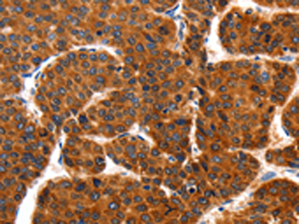 兔抗trap1多克隆抗体anti Trap1 Rabbit Polyclonal Antibody 生命科学产品与技术服务 生工生物工程