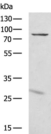 兔抗ACOX2多克隆抗体,Anti-ACOX2 rabbit polyclonal antibody 生命科学产品与技术服务-生工生物工程 ...