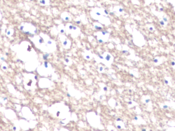 兔抗arc多克隆抗体anti Arc Rabbit Polyclonal Antibody 生命科学产品与技术服务 生工生物工程上海股份有限公司