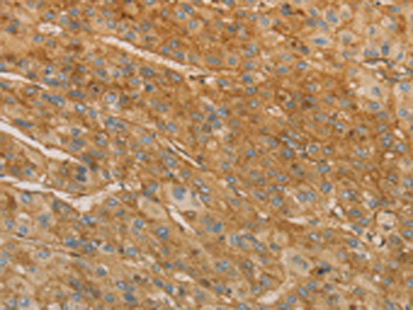 兔抗VTN多克隆抗体,Anti-VTN rabbit polyclonal antibody 生命科学产品与技术服务-生工生物工程(上海)股份有限公司