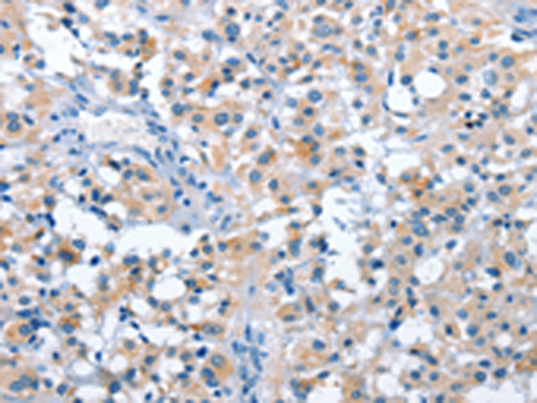 兔抗asb2多克隆抗体anti Asb2 Rabbit Polyclonal Antibody 生命科学产品与技术服务 生工生物工程上海