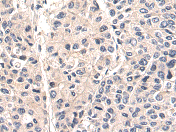 兔抗ACLY多克隆抗体,Anti-ACLY rabbit polyclonal antibody 生命科学产品与技术服务-生工生物工程(上海 ...