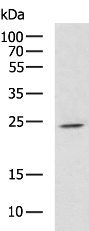 兔抗CIDEC多克隆抗体,Anti-CIDEC rabbit polyclonal antibody 生命科学产品与技术服务-生工生物工程 ...