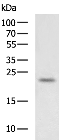 兔抗PAEP多克隆抗体,Anti-PAEP rabbit polyclonal antibody 生命科学产品与技术服务-生工生物工程(上海 ...
