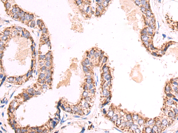 兔抗got2多克隆抗体anti Got2 Rabbit Polyclonal Antibody 生命科学产品与技术服务 生工生物工程上海