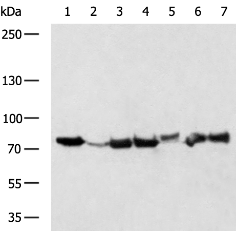 兔抗HADHA多克隆抗体,Anti-HADHA rabbit polyclonal antibody 生命科学产品与技术服务-生工生物工程 ...