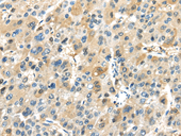 兔抗TRAIP多克隆抗体,Anti-TRAIP rabbit polyclonal antibody 生命科学产品与技术服务-生工生物工程 ...