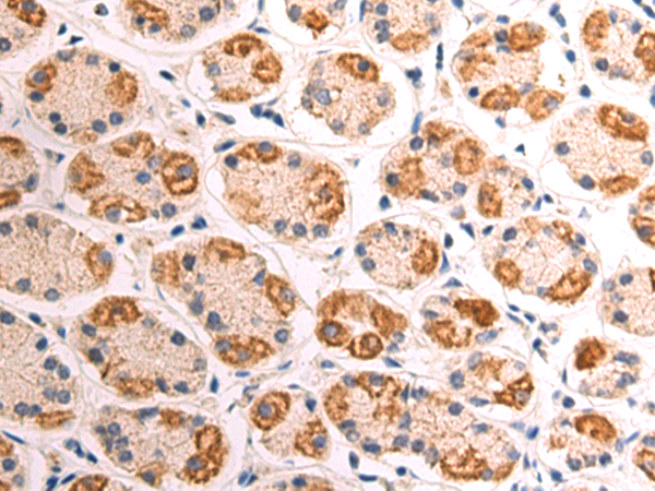 兔抗DLAT多克隆抗体,Anti-DLAT rabbit polyclonal antibody 生命科学产品与技术服务-生工生物工程(上海 ...