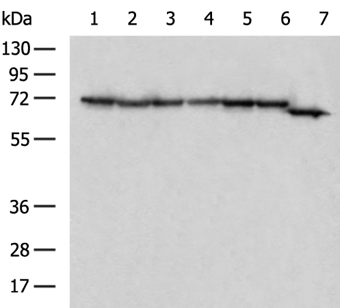 兔抗DLAT多克隆抗体,Anti-DLAT rabbit polyclonal antibody 生命科学产品与技术服务-生工生物工程(上海 ...