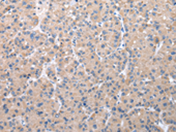 兔抗ZDHHC20多克隆抗体,Anti-ZDHHC20 rabbit polyclonal antibody 生命科学产品与技术服务-生工生物 ...