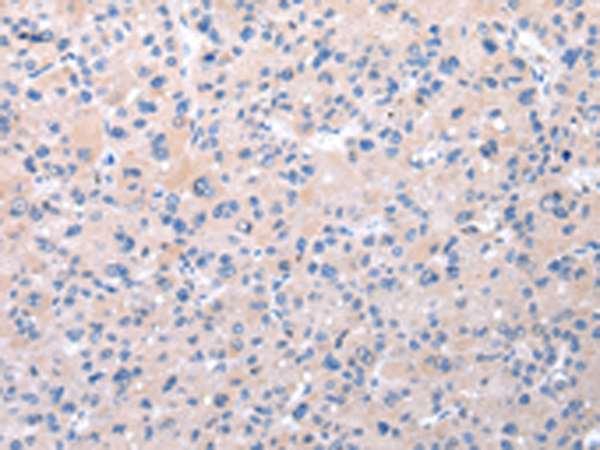 兔抗RNF115多克隆抗体,Anti-RNF115 rabbit polyclonal antibody 生命科学产品与技术服务-生工生物工程 ...