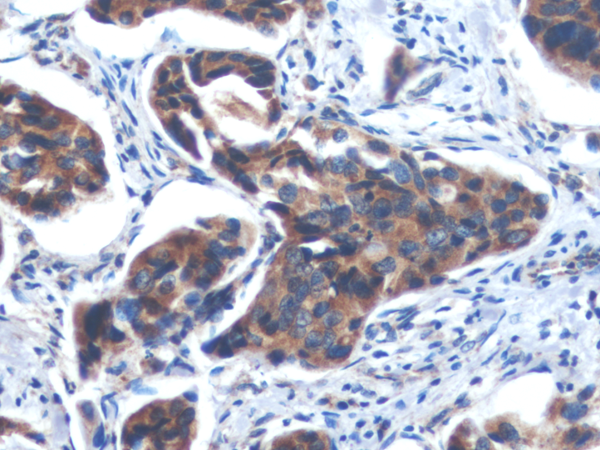 兔抗SETD3多克隆抗体,Anti-SETD3 rabbit polyclonal antibody 生命科学产品与技术服务-生工生物工程 ...