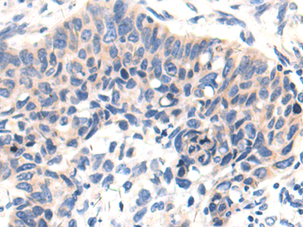 兔抗uap1多克隆抗体anti Uap1 Rabbit Polyclonal Antibody 生命科学产品与技术服务 生工生物工程上海