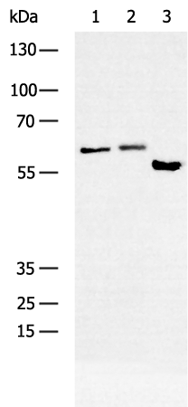 兔抗USP14多克隆抗体,Anti-USP14 rabbit polyclonal antibody 生命科学产品与技术服务-生工生物工程 ...