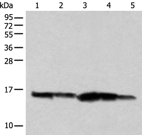 兔抗CISD1多克隆抗体,Anti-CISD1 rabbit polyclonal antibody 生命科学产品与技术服务-生工生物工程(上海)股份有限公司