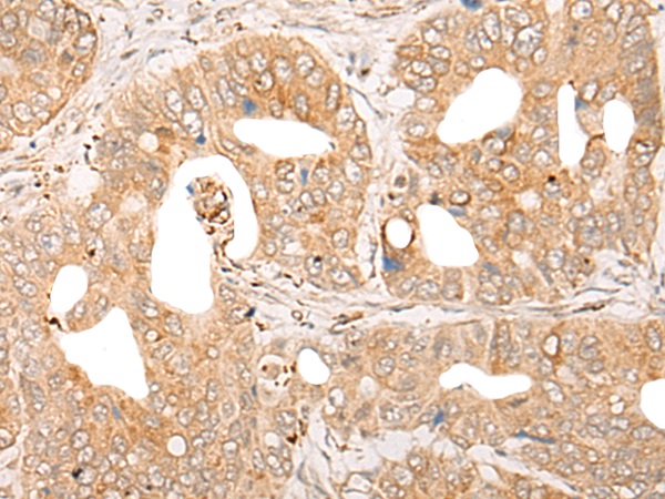 兔抗cpne6多克隆抗体anti Cpne6 Rabbit Polyclonal Antibody 生命科学产品与技术服务 生工生物工程