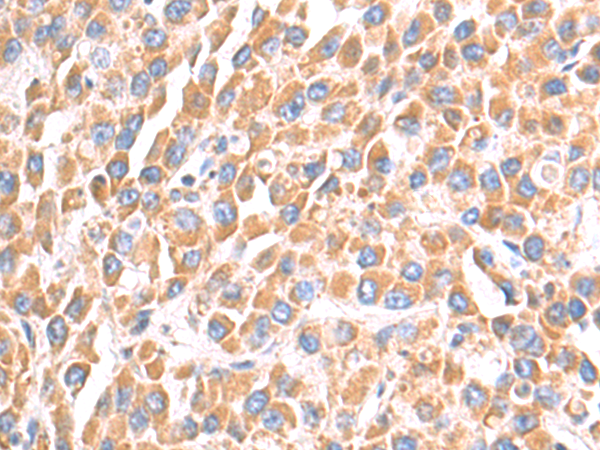 兔抗PDHA1多克隆抗体,Anti-PDHA1 rabbit polyclonal antibody 生命科学产品与技术服务-生工生物工程 ...