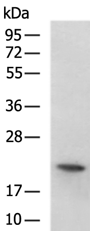 兔抗RAB18多克隆抗体,Anti-RAB18 rabbit polyclonal antibody 生命科学产品与技术服务-生工生物工程 ...