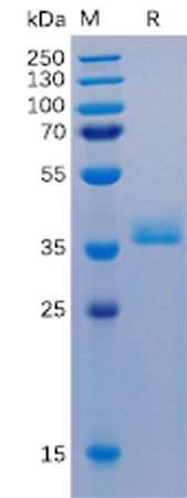人GPRC5D重组蛋白（hFc-6×His tag C-Terminus）,Human GPRC5D Recombinant protein (hFc-6×His tag C-Terminus ...