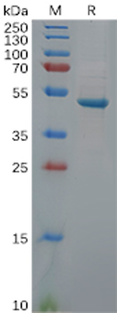 人UCHL1重组蛋白（hFc tag N-Terminus）,Human UCHL1 Recombinant protein (hFc tag ...