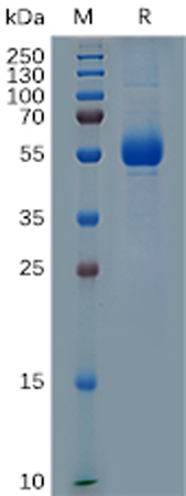 人CD33重组蛋白（hFc tag C-Terminus）,Human CD33 Recombinant protein (hFc tag C ...