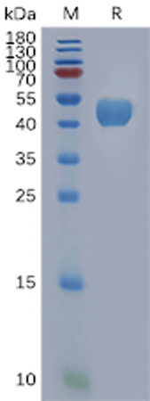 人BST2重组蛋白（hFc tag N-Terminus）,Human BST2 Recombinant protein (hFc tag N ...