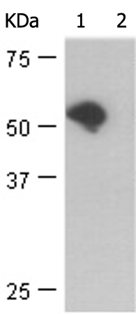 兔抗TP53 (mutated R175H)多克隆抗体,Anti-TP53 (mutated R175H) rabbit polyclonal ...