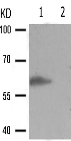 兔抗CAMK4（phospho-Thr196/200）多克隆抗体,Anti-CAMK4 (phospho-Thr196/200) rabbit polyclonal antibody 生命科学 ...