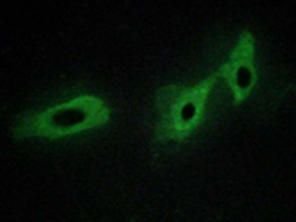 兔抗MID1多克隆抗体,Anti-MID1 rabbit polyclonal antibody 生命科学产品与技术服务-生工生物工程(上海)股份有限公司