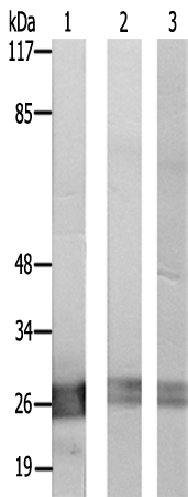 兔抗TNFSF12多克隆抗体,Anti-TNFSF12 rabbit polyclonal antibody 生命科学产品与技术服务-生工生物 ...