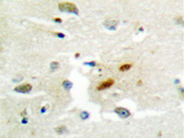兔抗rev3l多克隆抗体anti Rev3l Rabbit Polyclonal Antibody 生命科学产品与技术服务 生工生物工程