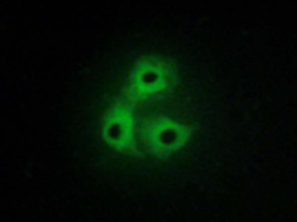 兔抗csk多克隆抗体anti Csk Rabbit Polyclonal Antibody 生命科学产品与技术服务 生工生物工程上海股份有限公司