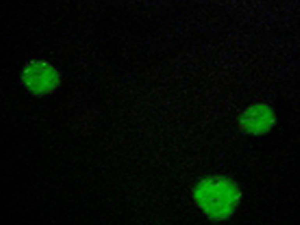 兔抗hlx多克隆抗体anti Hlx Rabbit Polyclonal Antibody 生命科学产品与技术服务 生工生物工程上海股份有限公司