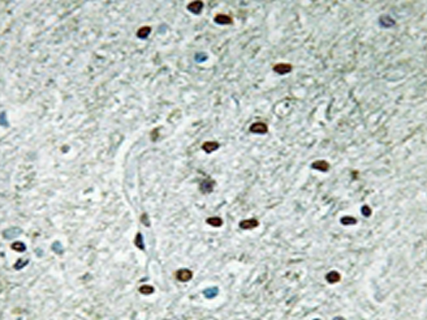 兔抗REXO1多克隆抗体,Anti-REXO1 rabbit polyclonal antibody 生命科学产品与技术服务-生工生物工程 ...