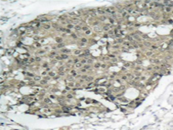 兔抗akt1（ab 308）多克隆抗体anti Akt1 Ab 308 Rabbit Polyclonal Antibody 生命科学