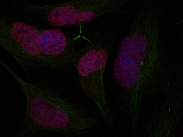 兔抗H2AFX多克隆抗体,Anti-H2AFX rabbit polyclonal antibody 生命科学产品与技术服务-生工生物工程 ...