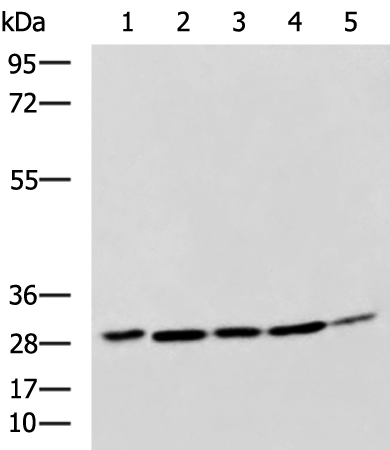 兔抗CEBPD多克隆抗体,Anti-CEBPD rabbit polyclonal antibody 生命科学产品与技术服务-生工生物工程 ...