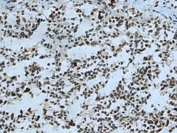 兔抗ESR2多克隆抗体,Anti-ESR2 rabbit polyclonal antibody 生命科学产品与技术服务-生工生物工程(上海 ...