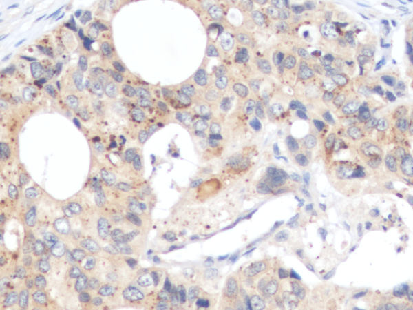 兔抗GAS6多克隆抗体,Anti-GAS6 rabbit polyclonal antibody 生命科学产品与技术服务-生工生物工程(上海 ...