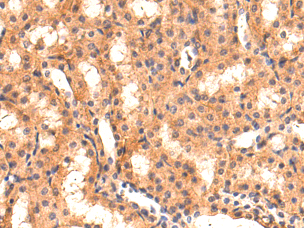 兔抗UTS2R多克隆抗体,Anti-UTS2R rabbit polyclonal antibody 生命科学产品与技术服务-生工生物工程 ...