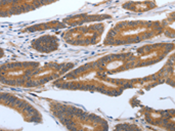 兔抗podxl多克隆抗体anti Podxl Rabbit Polyclonal Antibody 生命科学产品与技术服务 生工生物工程