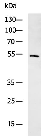 兔抗TFAP2C多克隆抗体,Anti-TFAP2C rabbit polyclonal antibody 生命科学产品与技术服务-生工生物工程 ...