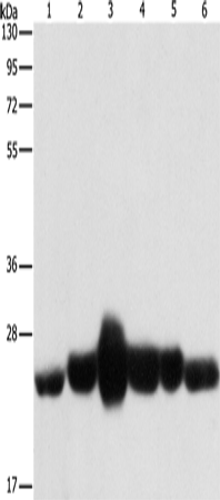 兔抗CAV1多克隆抗体,Anti-CAV1 rabbit polyclonal antibody 生命科学产品与技术服务-生工生物工程(上海 ...