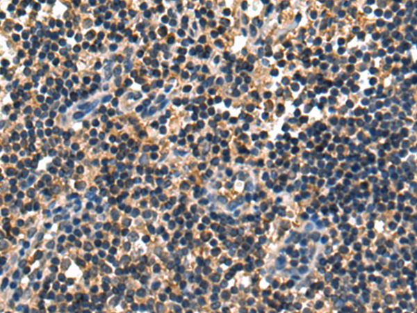 兔抗BGLAP多克隆抗体,Anti-BGLAP rabbit polyclonal antibody 生命科学产品与技术服务-生工生物工程 ...