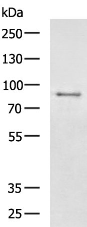 兔抗PLA2G4B多克隆抗体,Anti-PLA2G4B rabbit polyclonal antibody 生命科学产品与技术服务-生工生物 ...