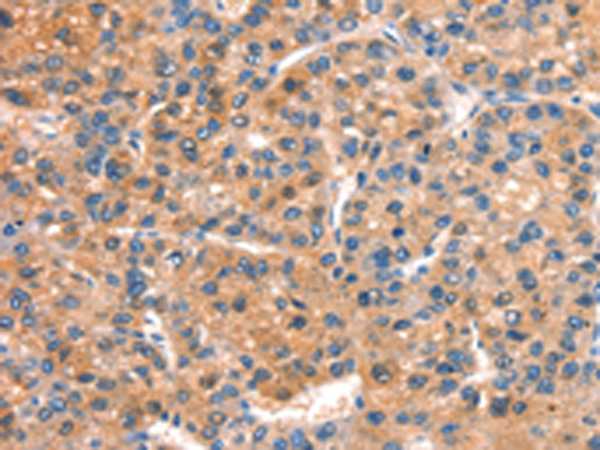 兔抗DOCK1多克隆抗体,Anti-DOCK1 rabbit polyclonal antibody 生命科学产品与技术服务-生工生物工程 ...